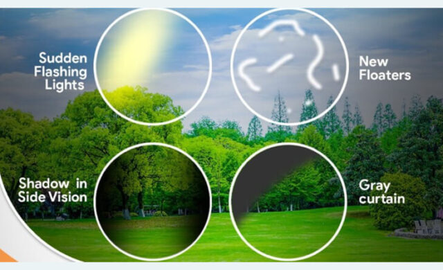 Everything You Need to Know About Retinal Detachment