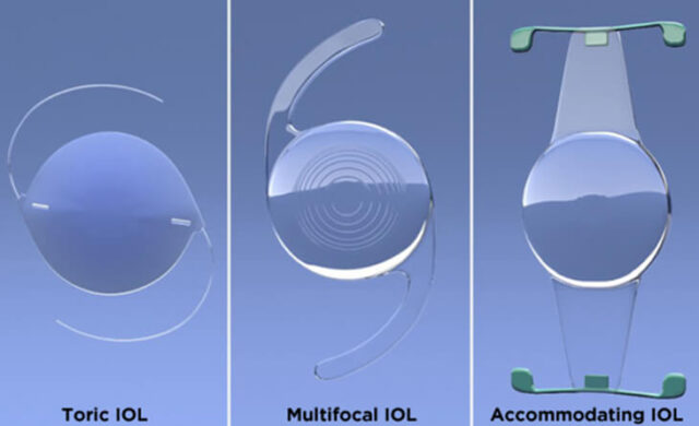 What is the Standard Lens Used for Cataract Surgery?