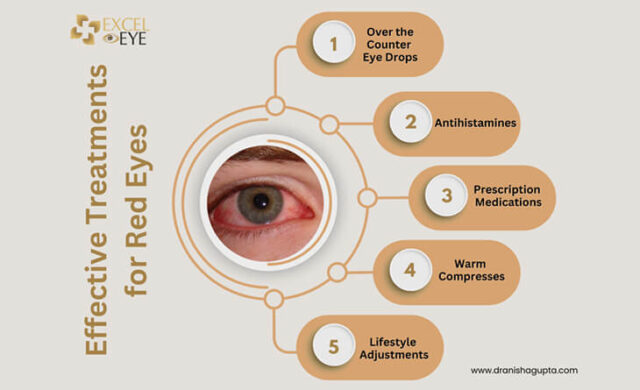 Red and Bloodshot Eyes: Causes & Treatment